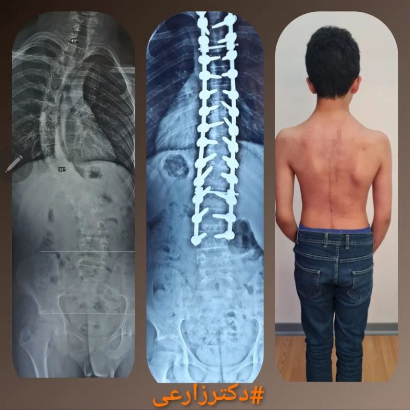 Dr. Mohammad Zarei - spine surgery specialist in Iran - Iran Medical Visa