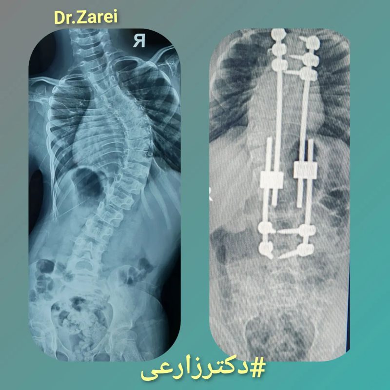 Dr. Mohammad Zarei - spine surgery specialist in Iran - Iran Medical Visa