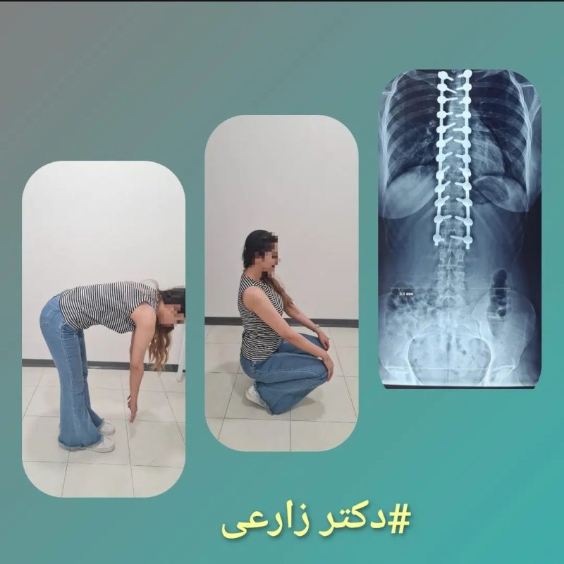 Dr. Mohammad Zarei - spine surgery specialist in Iran - Iran Medical Visa