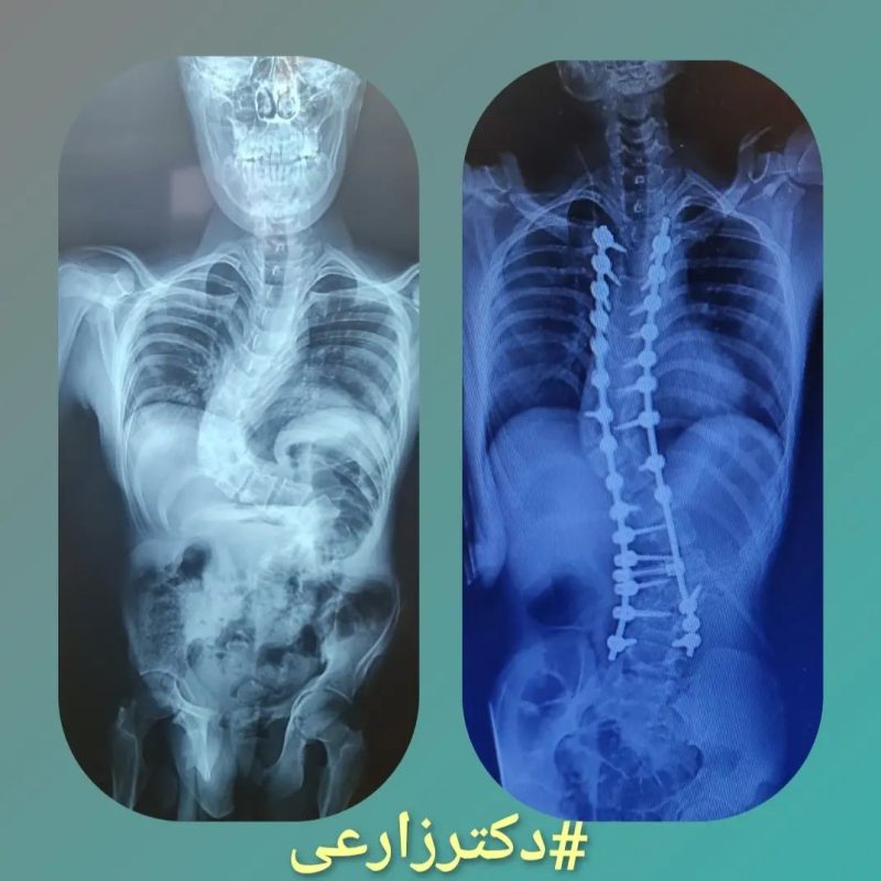 Dr. Mohammad Zarei - spine surgery specialist in Iran - Iran Medical Visa