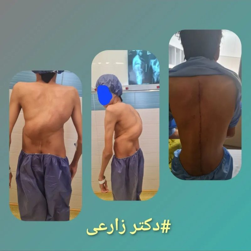 Dr. Mohammad Zarei - spine surgery specialist in Iran - Iran Medical Visa