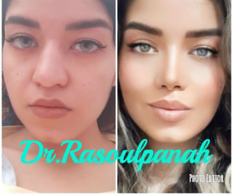 Dr. Hossein Rasool Panah - Iran Medical Visa