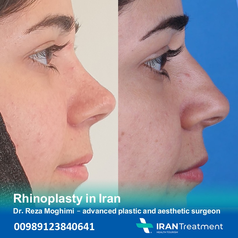 Dr. Mohammad Reza Moghimi - Iran Medical Visa